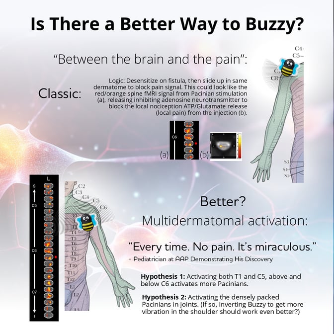 Buzzy® Vaccine Pain Relief Just Got Better: The New Placement Method ...
